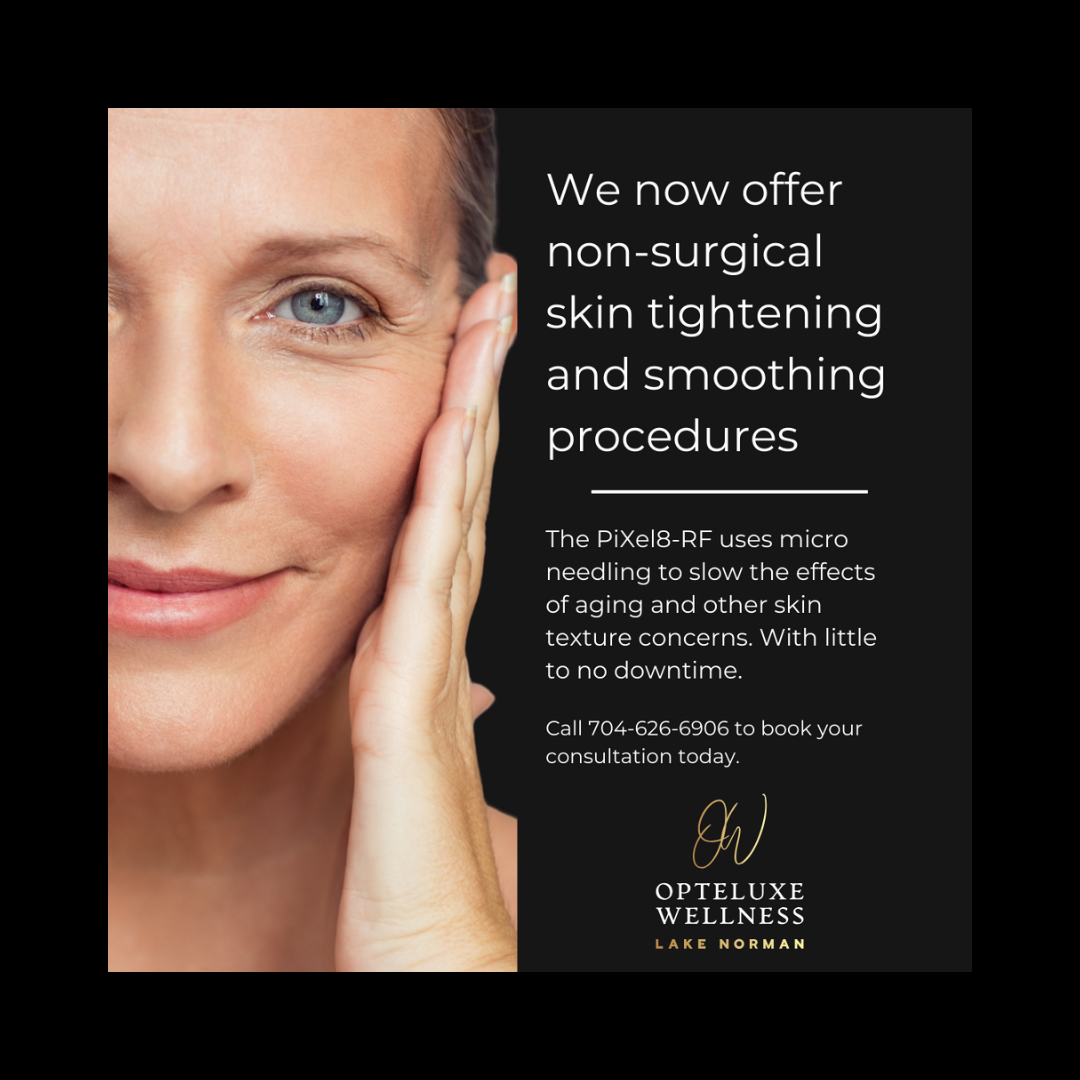 Discover the Skin Benefits of PIXEL8 RF Microneedling at Opteluxe ...